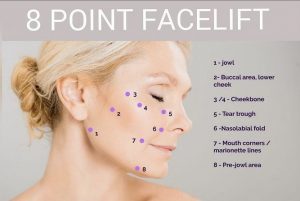 8 Point Facelift - Blossom Aesthetics
